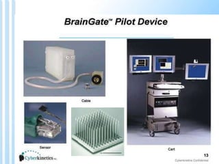 Brain Gate Technology | PPT