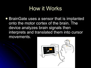 Brain gatepowerpoint(k) | PPT