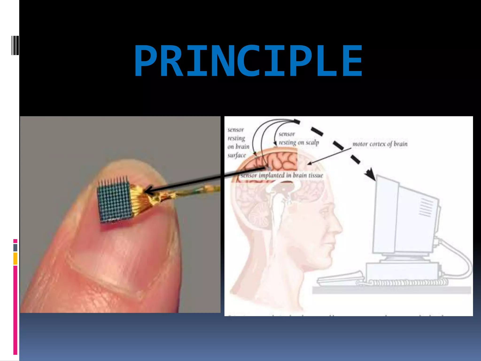 Brain gate system | PPTX