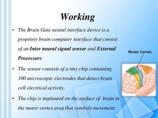 Braingate system | PPT