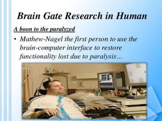 Braingate system | PPT