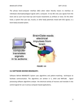 Brain gate system document | DOCX