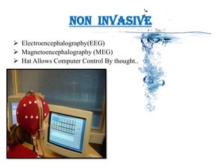 Brain gate technology | PPTX