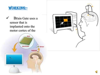 Brain gate technology | PPTX