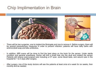 Braingate technology | PPTX