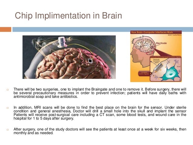 Braingate technology