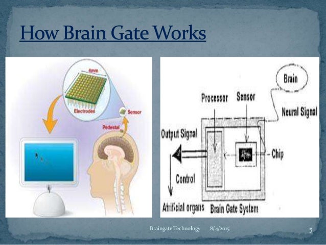 Brain gate technology