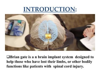 Brain gate technology | PPT