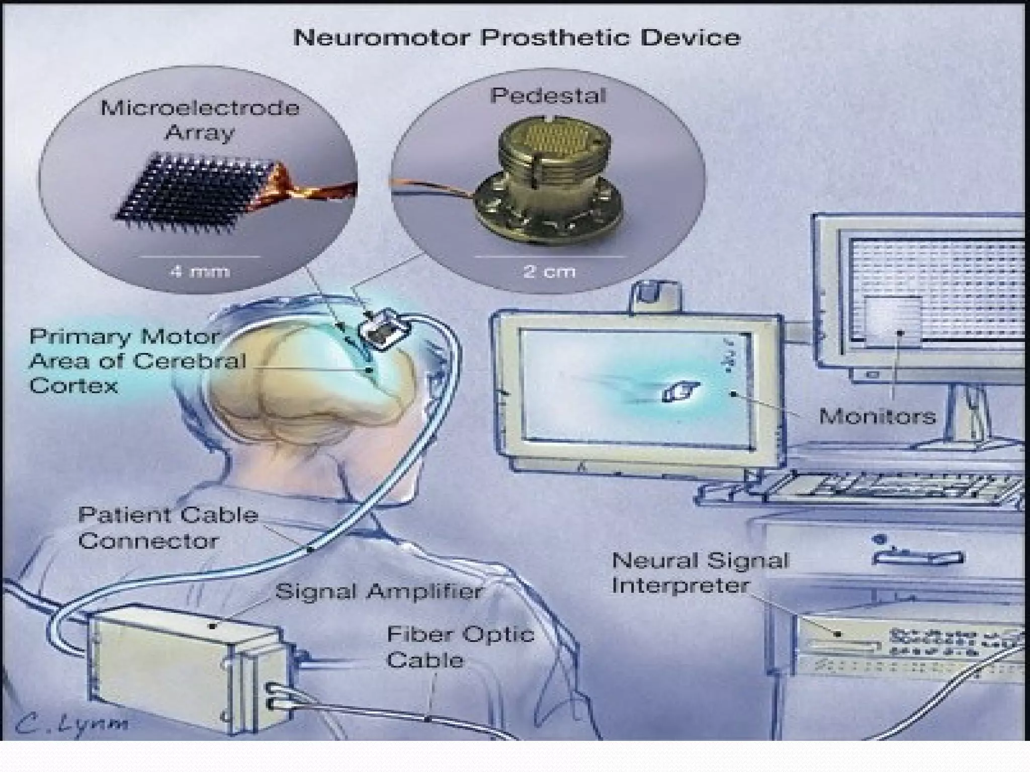 Brain gate technology | PPT