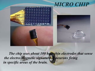 Brain gate technology | PPT