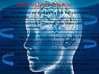 Brain gate technology | PDF