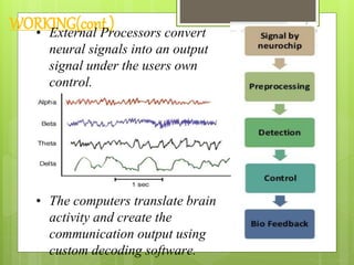 brain gate system | PPT