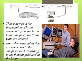 brain gate system | PPT