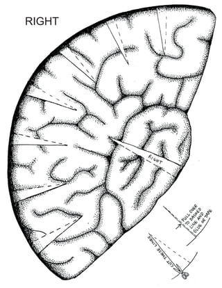Brain hatbw | PDF