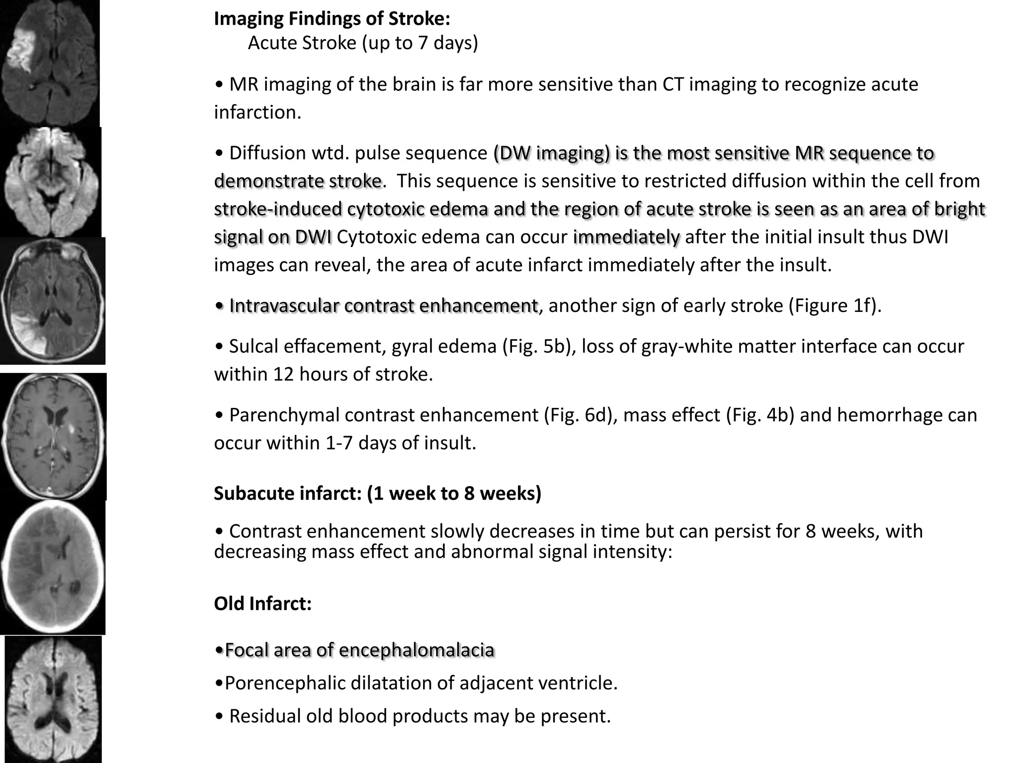Radiology of Brain hemorrhage vs infarction | PPTX