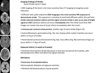 Radiology of Brain hemorrhage vs infarction | PPTX