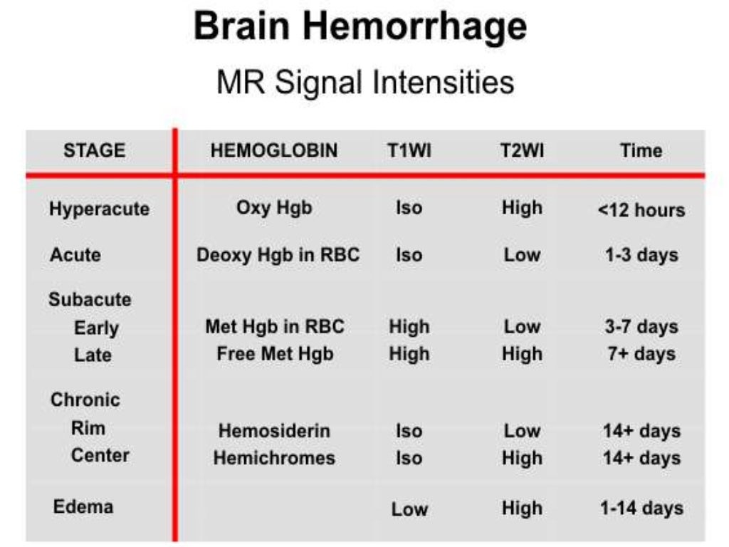 Radiology of Brain hemorrhage vs infarction