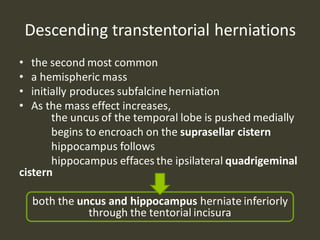 Brain herniation imaging | PDF