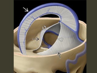Brain herniation imaging | PDF