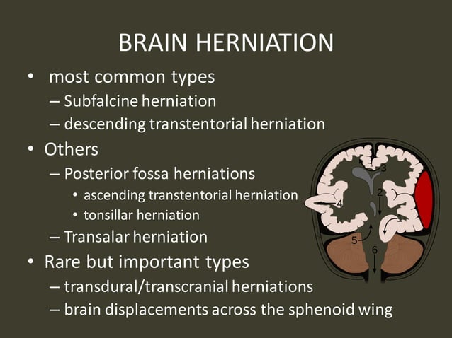 Brain herniation imaging | PDF