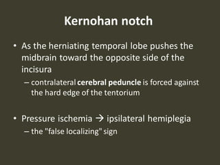 Brain herniation imaging | PPT