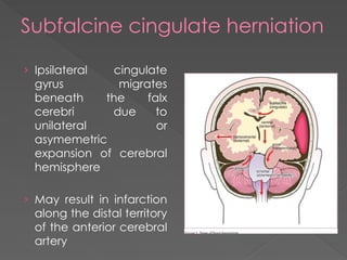 BRAIN HERNIATION LECTURES IN ANATOMICAL PATHOLOGY.pptx