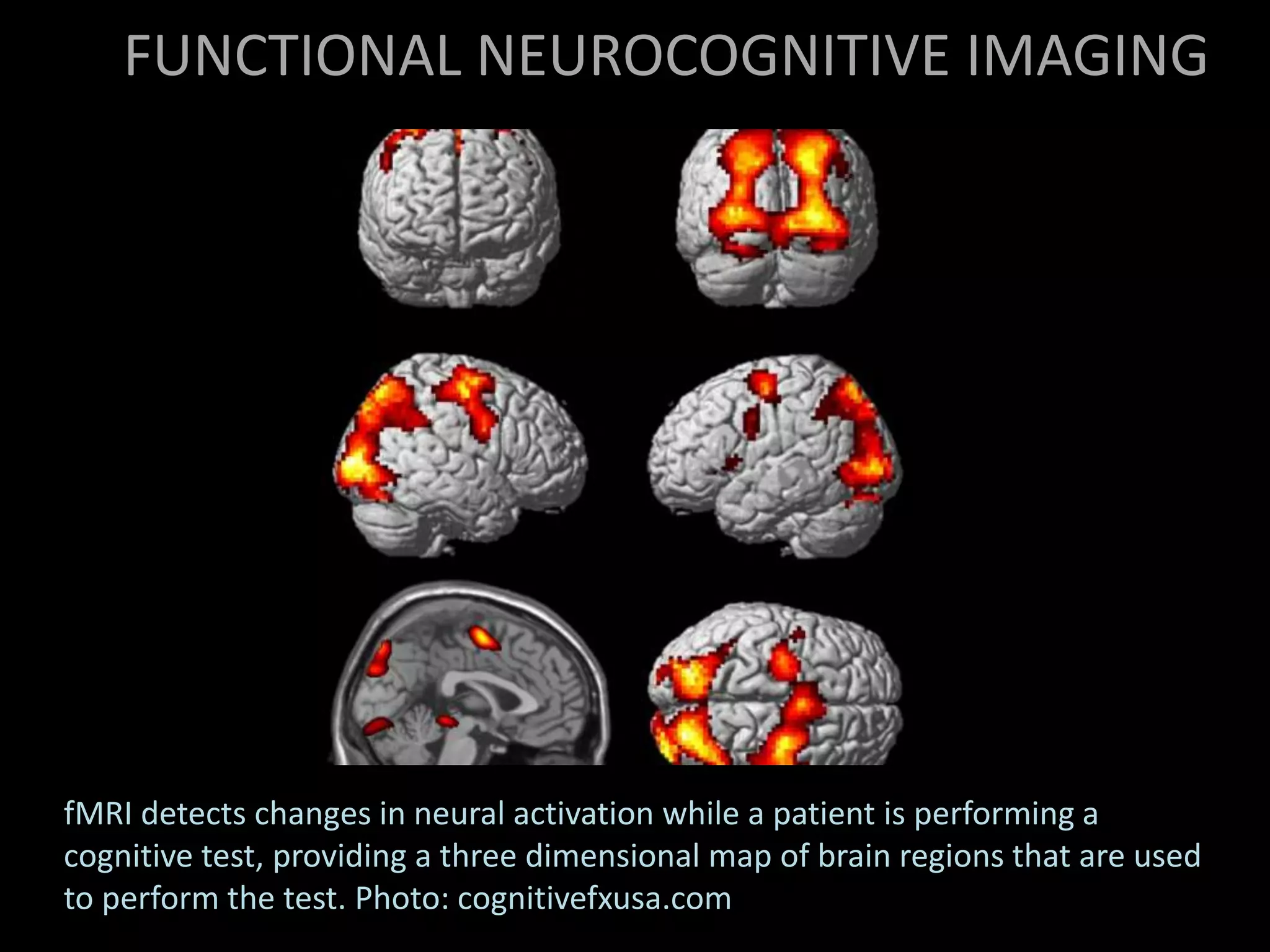 Brain imaging and imagining | PPTX