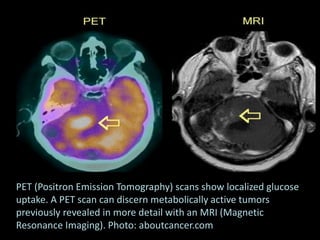 Brain imaging and imagining | PPTX