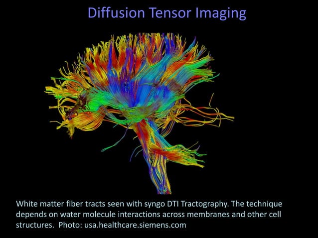 Brain imaging and imagining | PPT