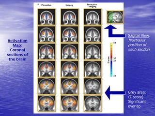Brain Imaging & Imagining Final | PDF