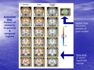 Brain Imaging & Imagining Final | PDF