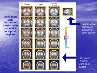 Brain Imaging & Imagining Final | PDF