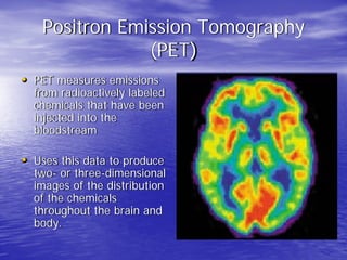 Brain Imaging & Imagining Final | PDF