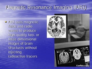 Brain Imaging & Imagining Final | PDF