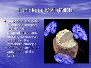Brain Imaging & Imagining Final | PDF