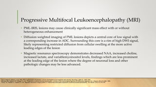 Brain Imaging in Patients with HIV Infection | PPTX