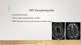 Brain Imaging in Patients with HIV Infection | PPTX