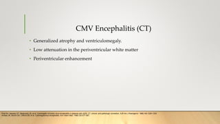 Brain Imaging in Patients with HIV Infection | PPTX