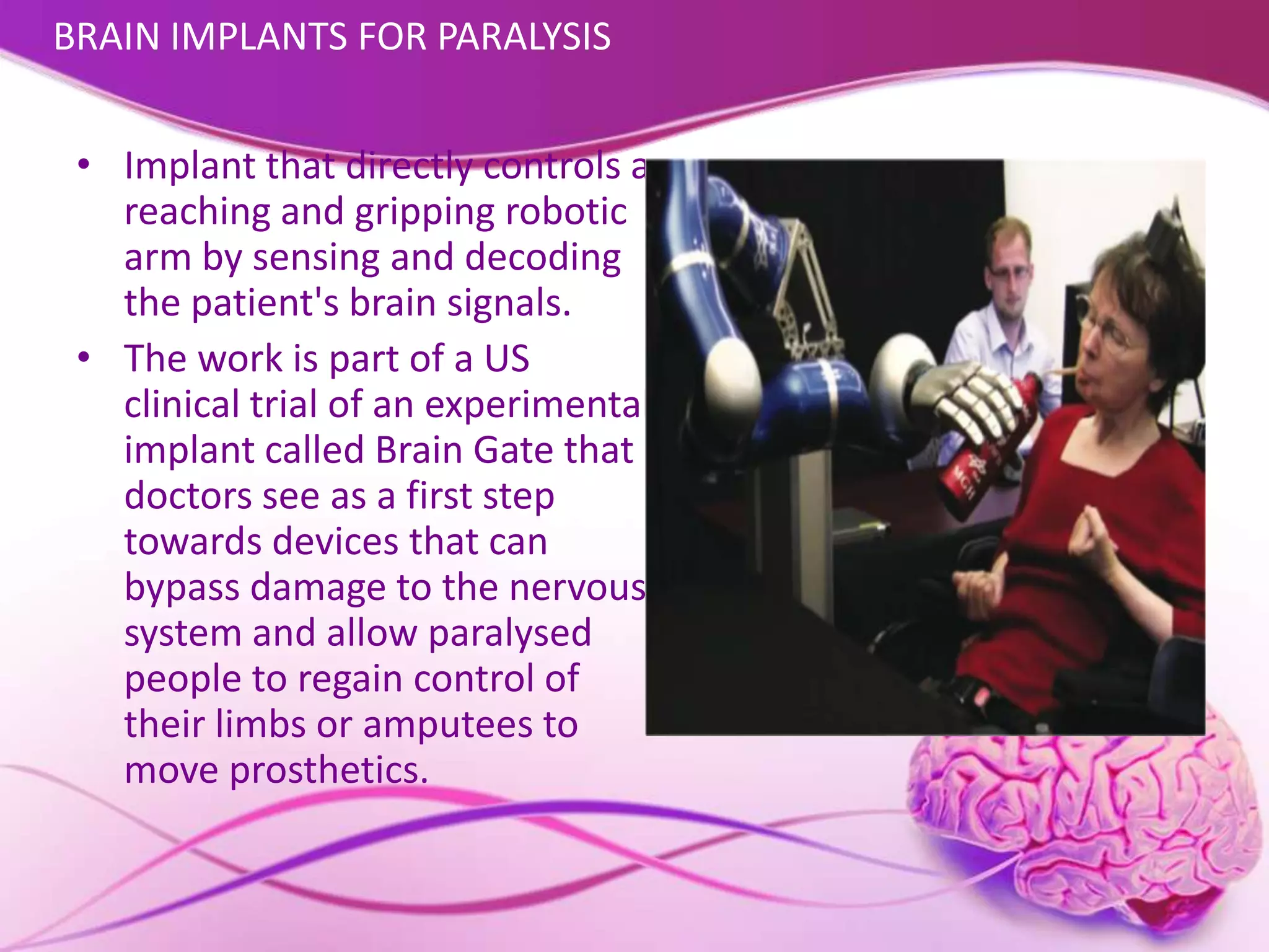 Brain implants By Neelima Sharma,M.Sc Biotechnology,Women Christian ...