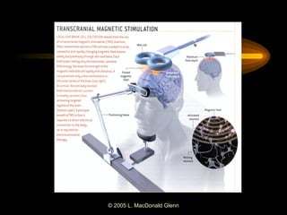 Brain In A Box McGill | PPT