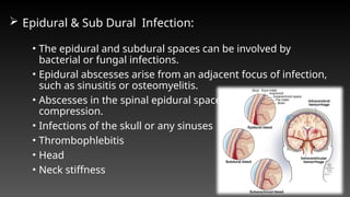 Brain Infections causes, diagnosis and treatment.pptx
