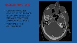 Brain Injuries in CT .pptxBrain Injuries in CT .pptxBrain Injuries in ...