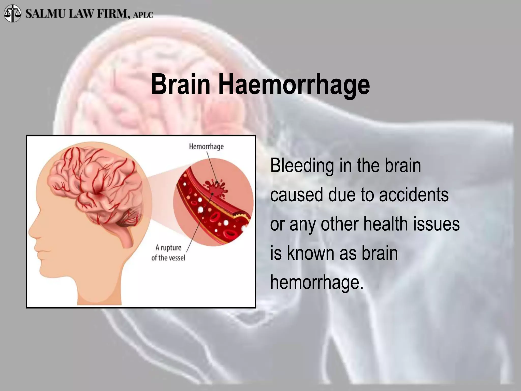 Types Of Brain Injury | PPTX