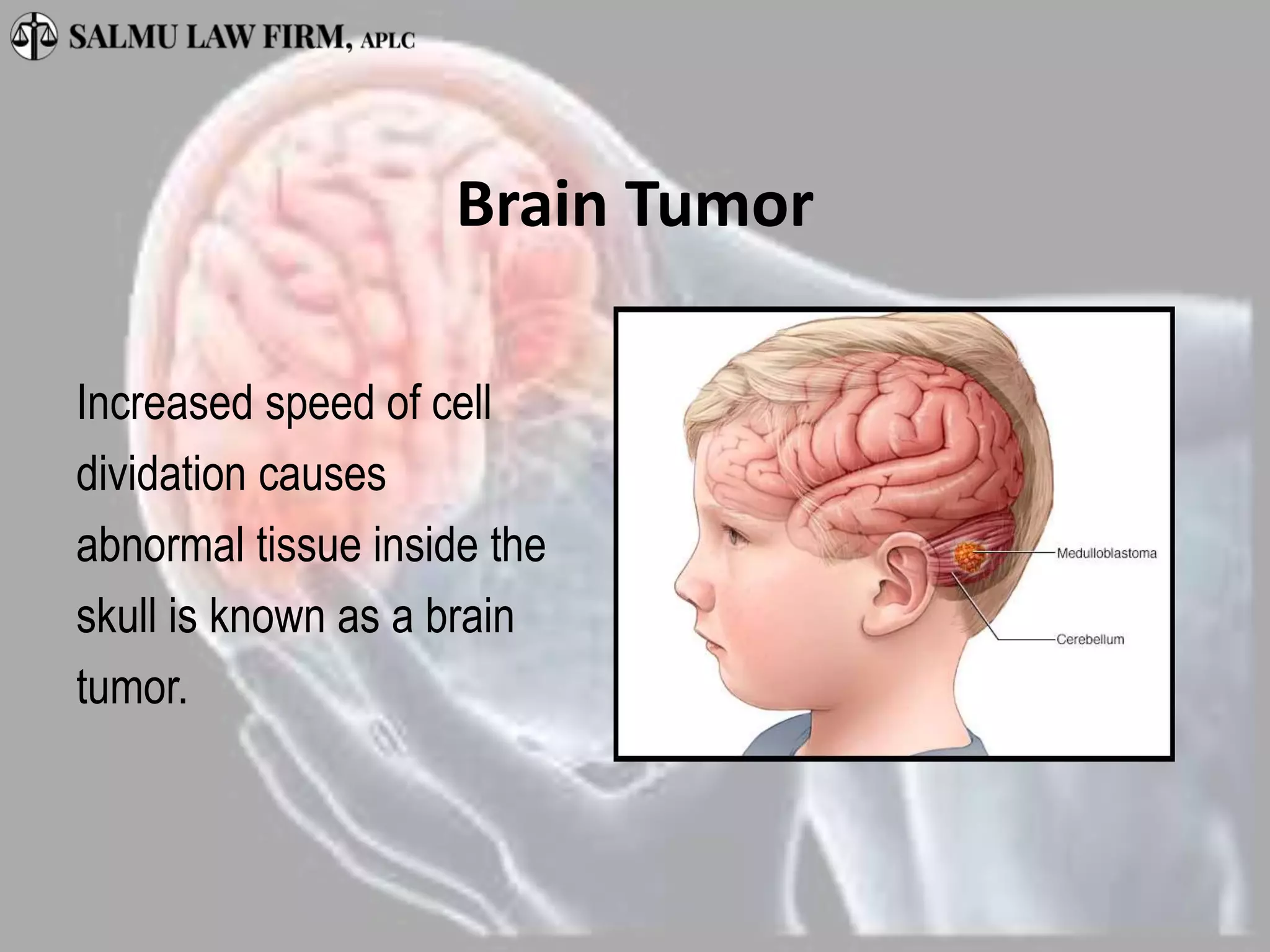 Types Of Brain Injury | PPTX
