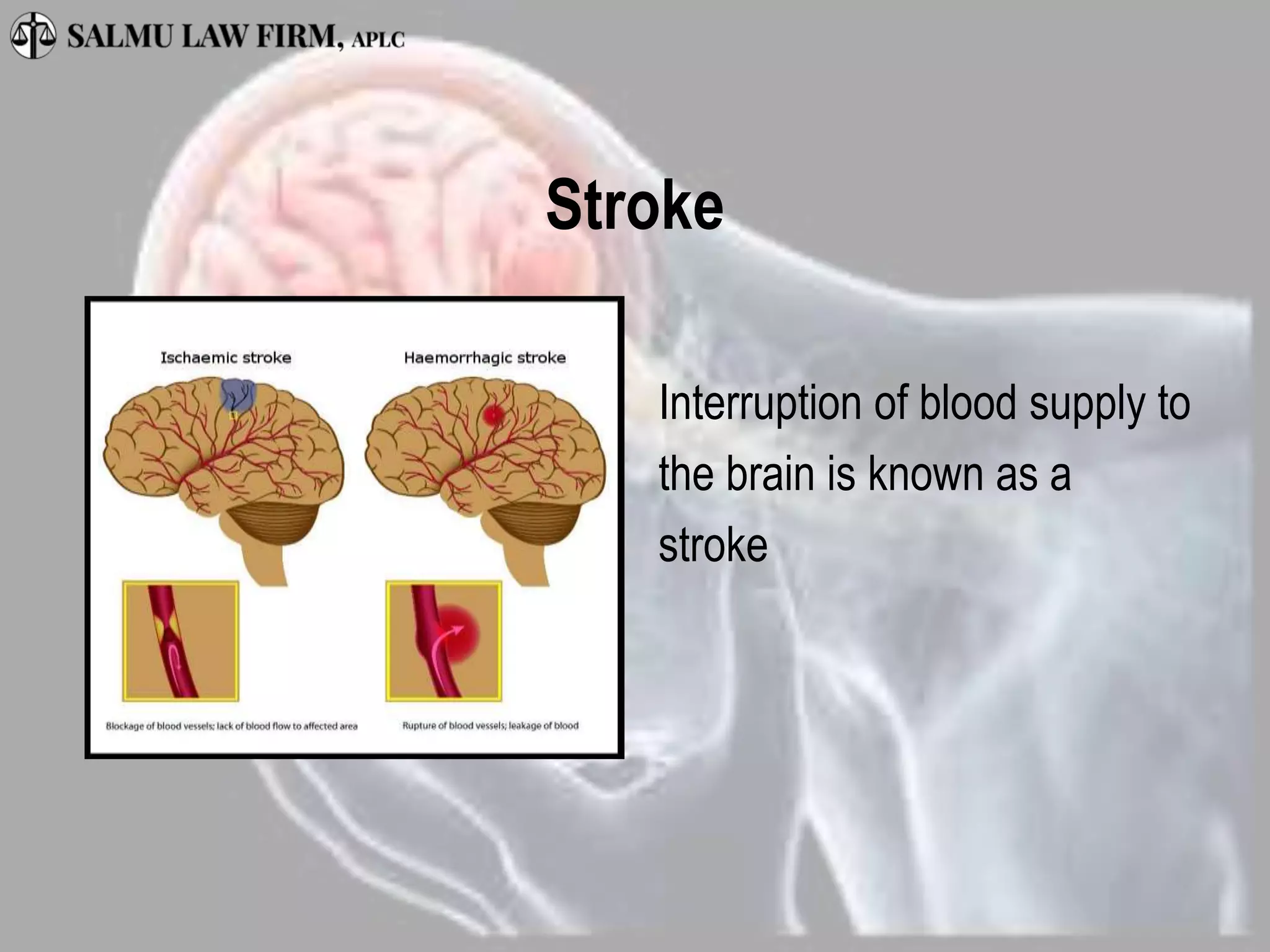 Types Of Brain Injury | PPTX