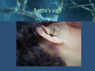 Brain injury1.ppt