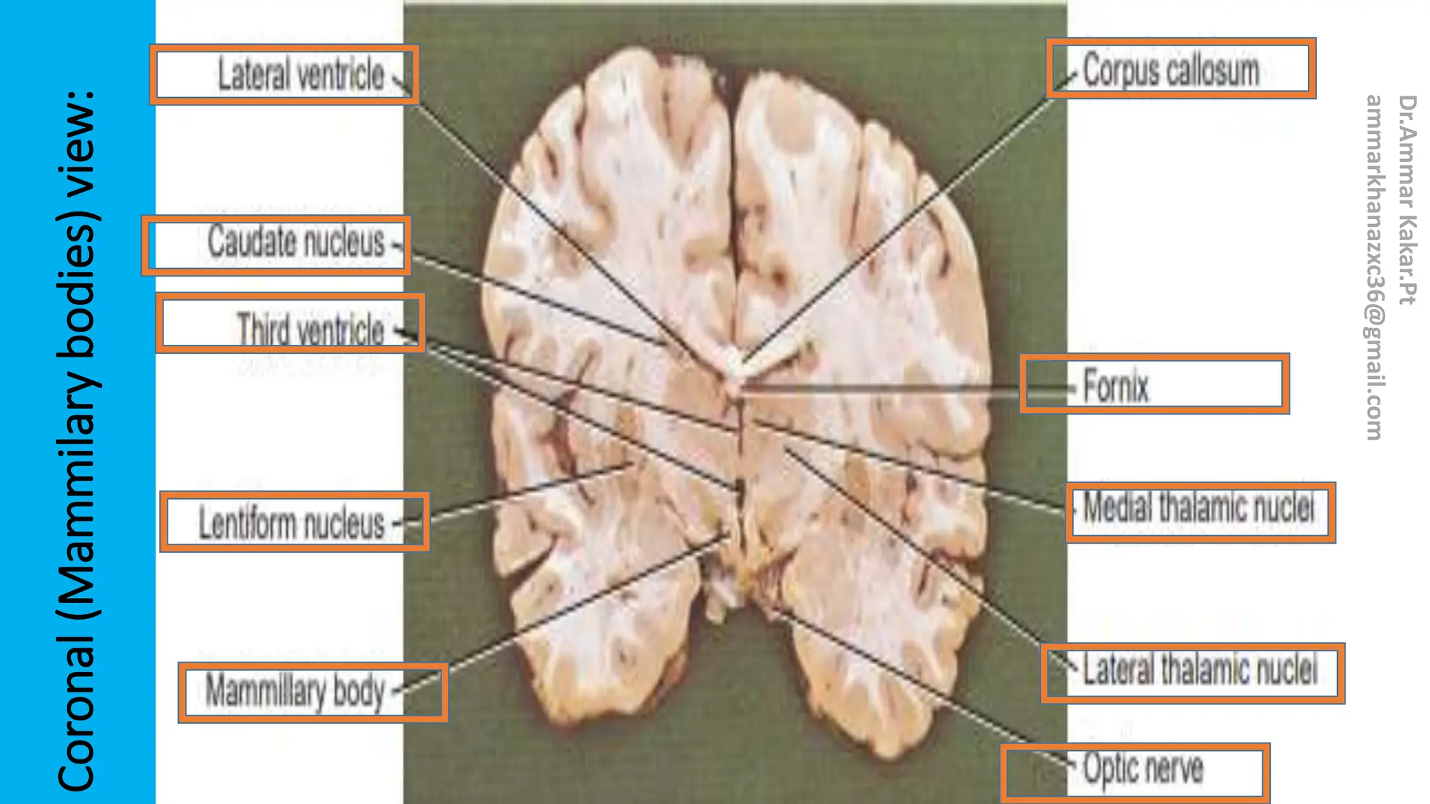 brain labelling neuroanatomy(introduction to neuroanatomy).pptx