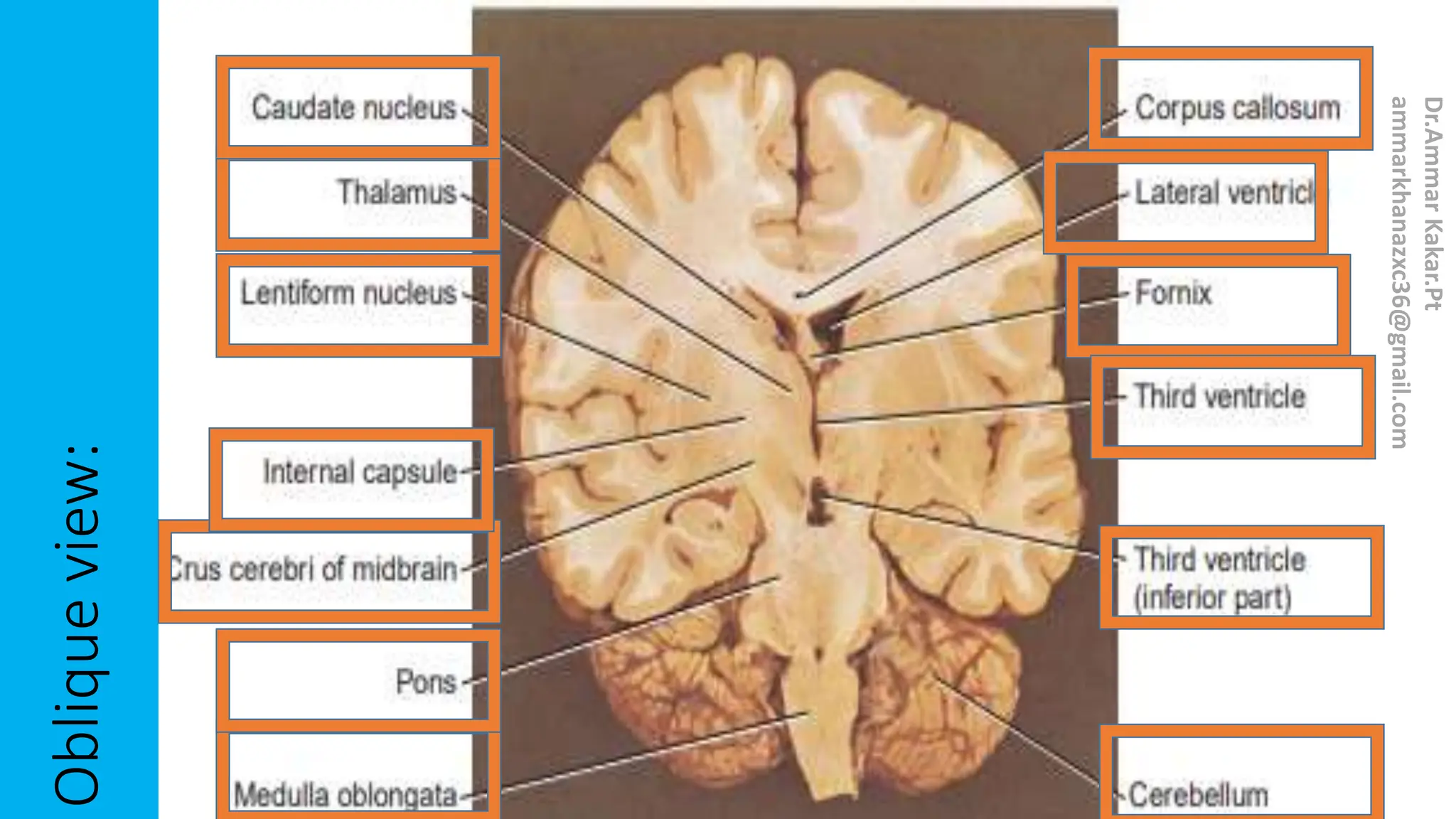 brain labelling neuroanatomy(introduction to neuroanatomy).pptx