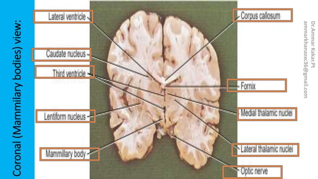 brain labelling neuroanatomy(introduction to neuroanatomy).pptx