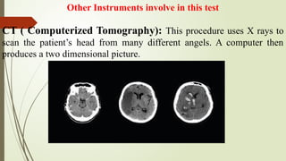 Brain Mapping Test; A psychology and Forensic Perspective | PPTX